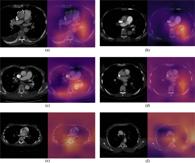 PENet—a scalable deep-learning model for automated diagnosis of ...
